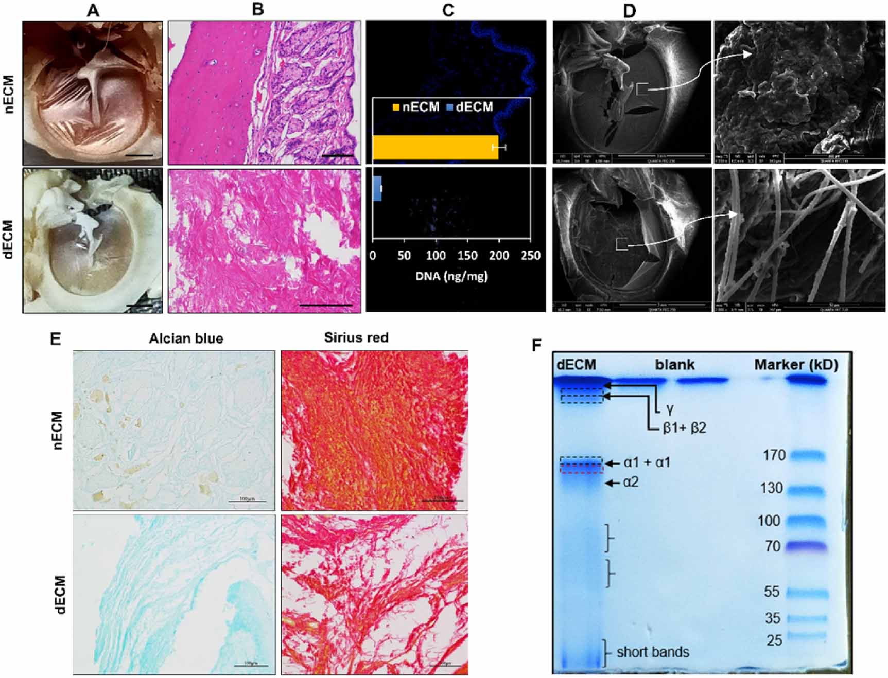 Multifaceted tannin crosslinked bioinspired dECM decorated nanofibers ...