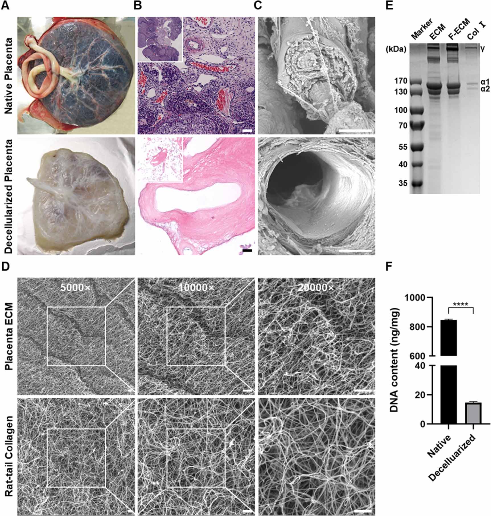 Bioink derived from human placenta supporting angiogenesis - IOPscience