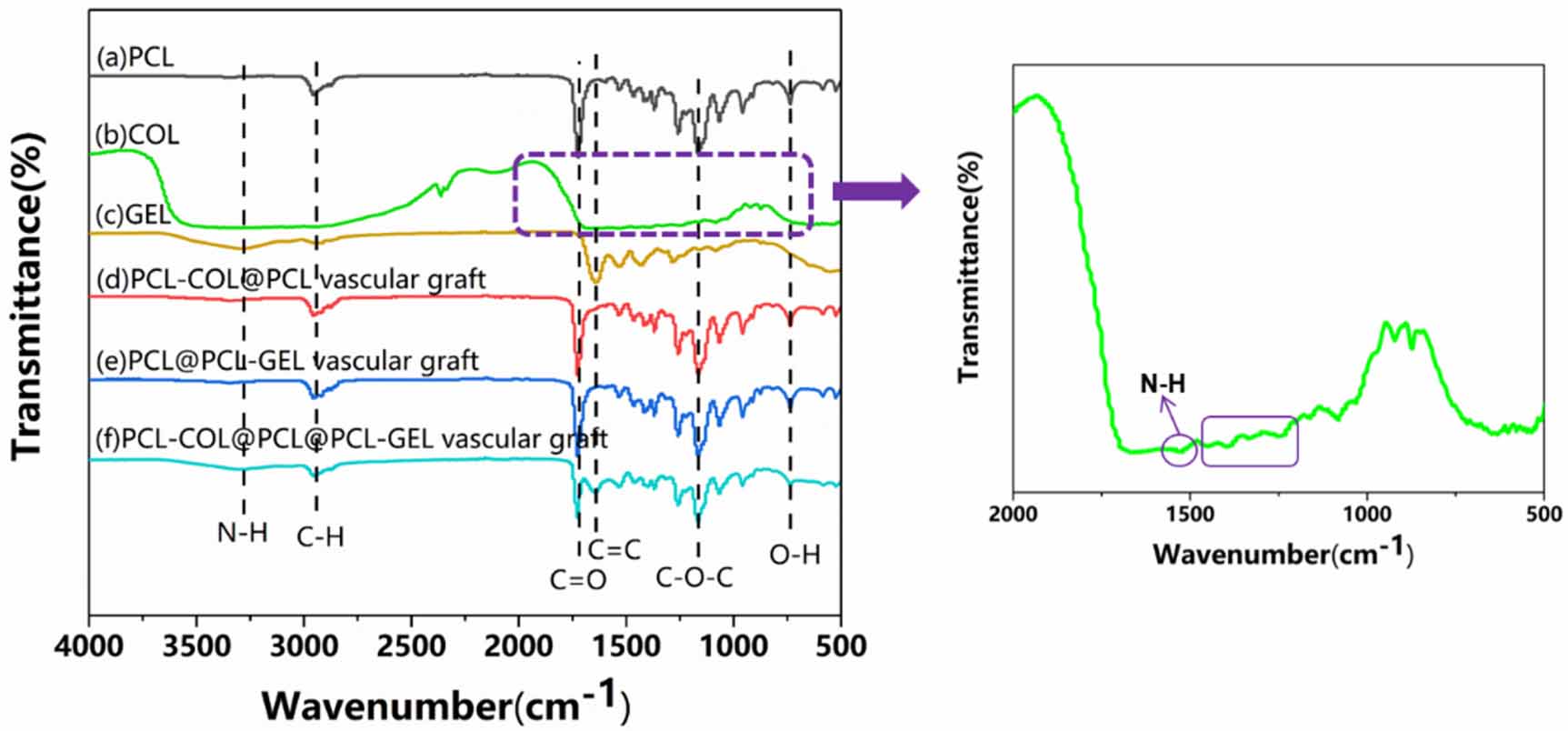 Construction of PCL-collagen@PCL@PCL-gelatin three-layer small diameter ...