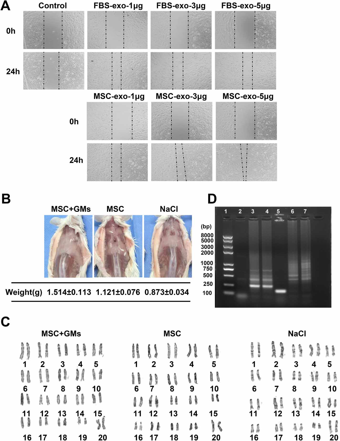 Umbilical cord derived mesenchymal stem cell-GelMA microspheres for ...