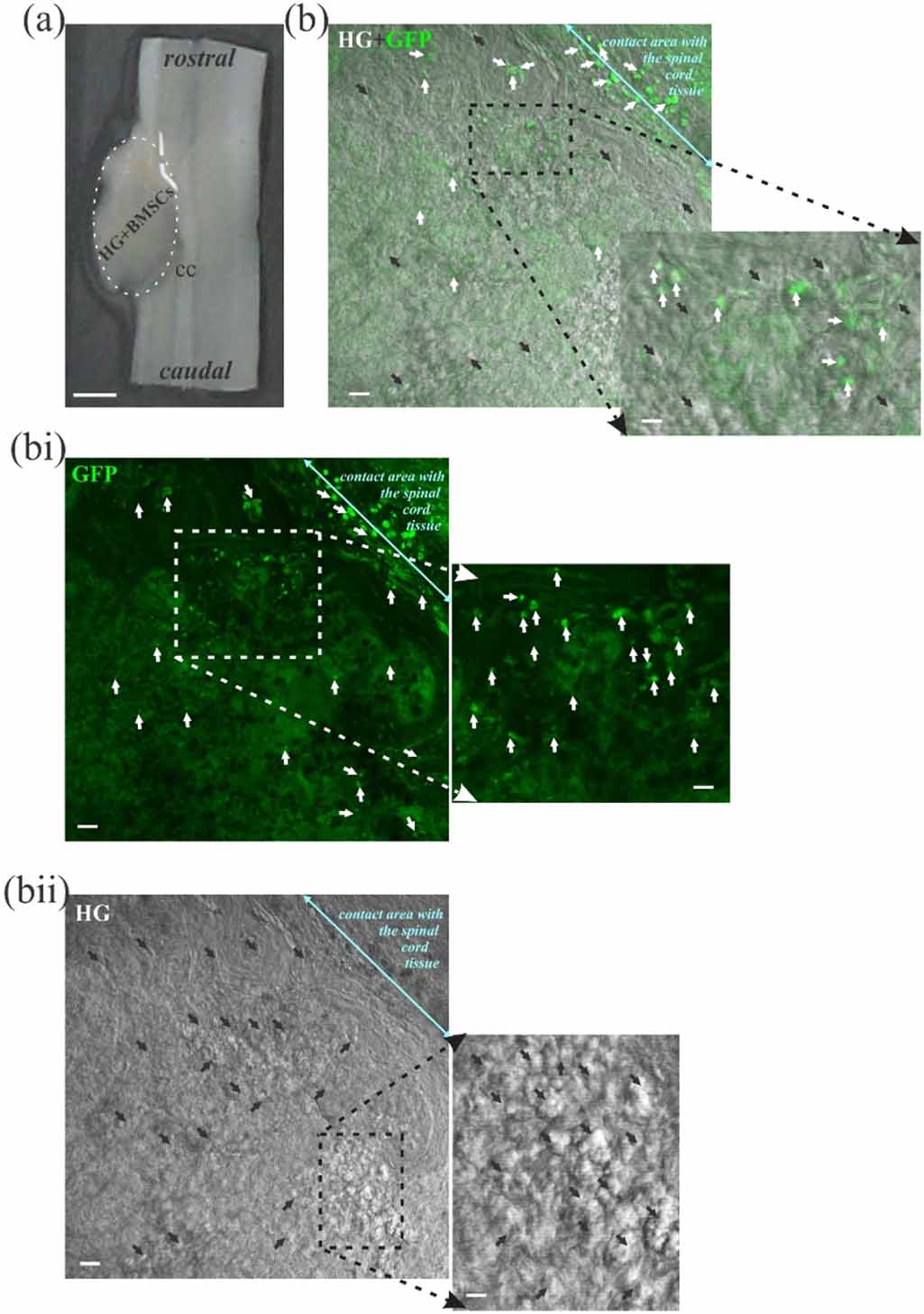 Heterogeneous pHPMA hydrogel promotes neuronal differentiation of bone ...