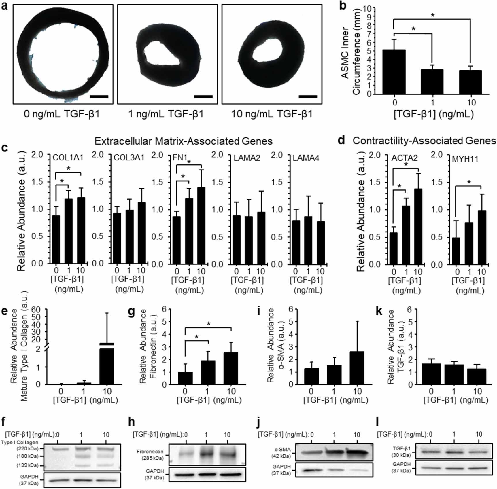 Cell-contact-mediated assembly of contractile airway smooth muscle ...