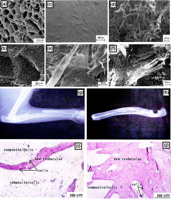 Nano-hydroxyapatite/collagen composite as scaffold material for bone ...