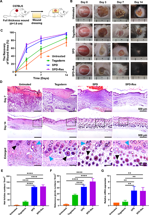 Resveratrol loaded native silk fiber-sericin hydrogel double ...