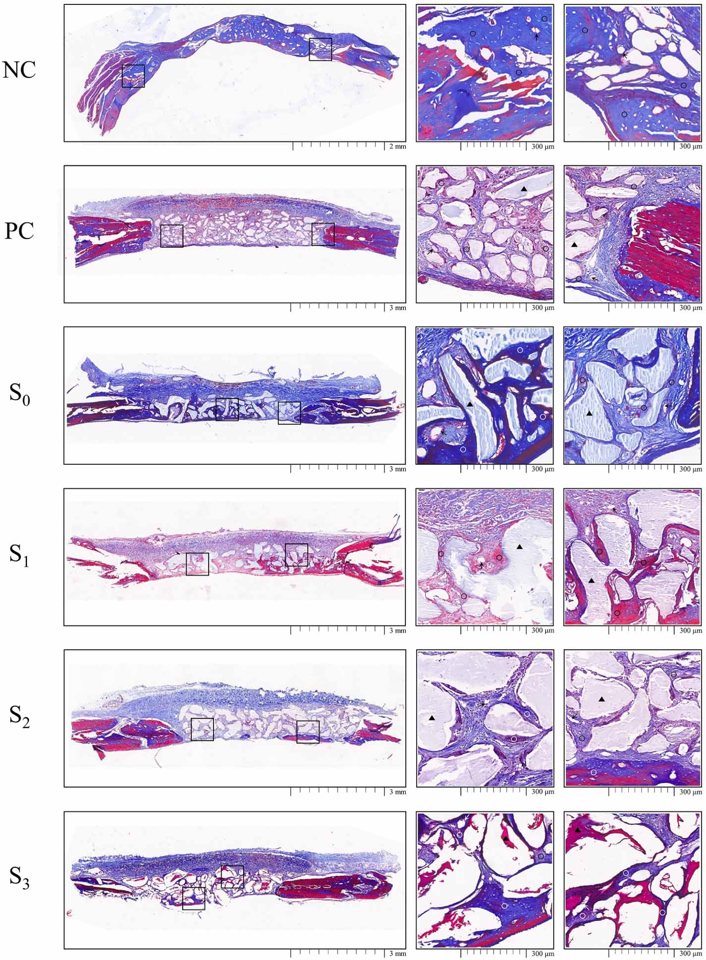 Optimized osteogenesis of porcine bone-derived xenograft through ...