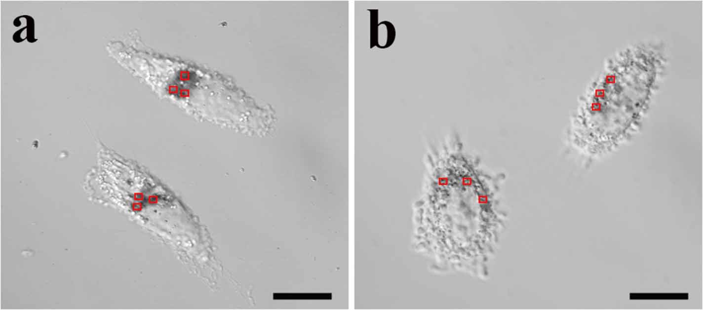 CeO2@CuS@PDA-FA as targeted near-infrared PTT/CDT therapeutic agents ...