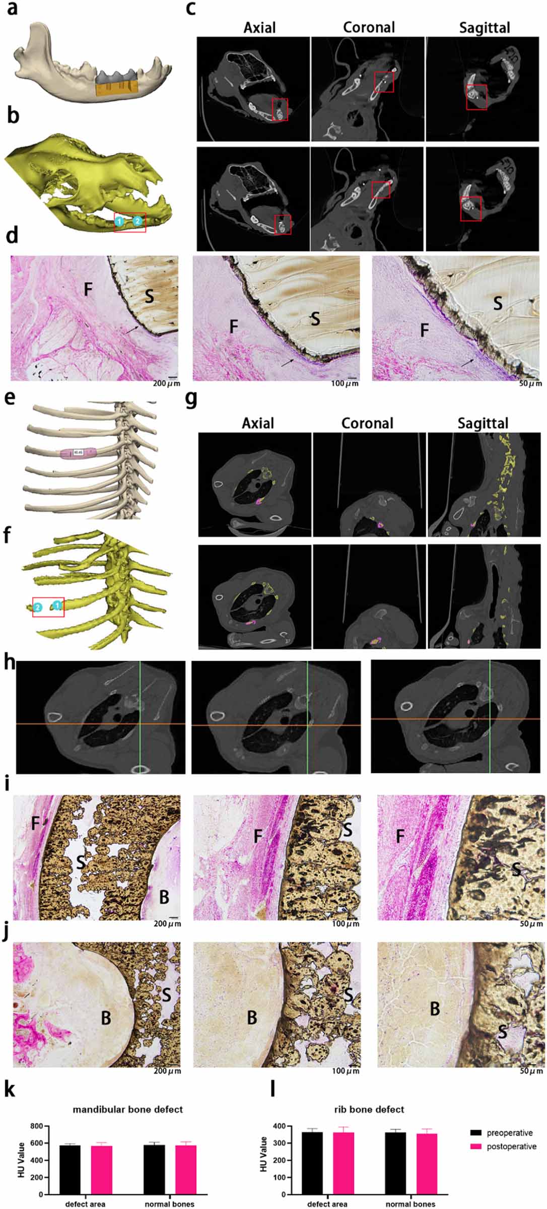 An HA/PEEK scaffold with modified crystallinity via 3D-bioprinting for ...