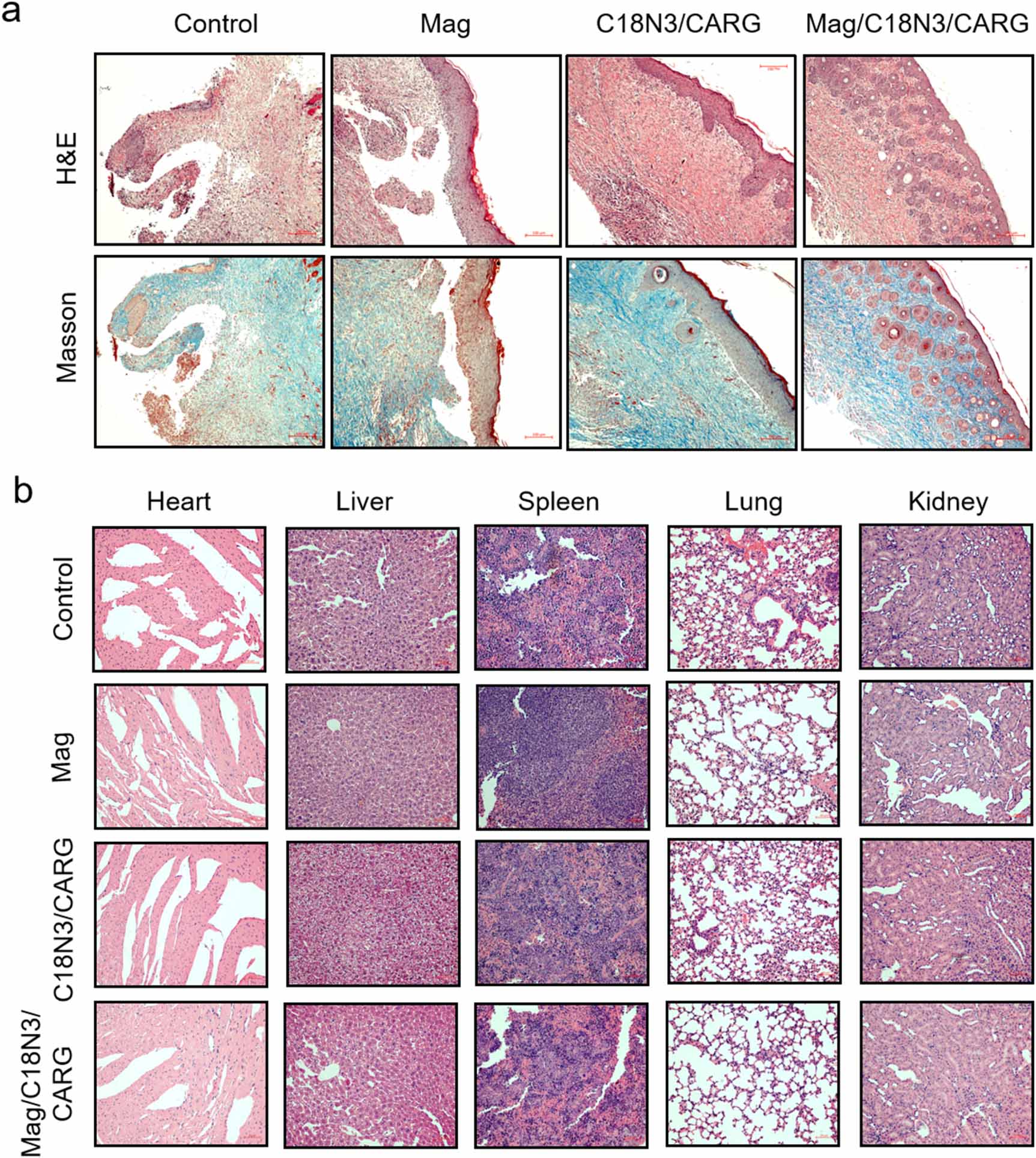 Bacteria-targeted magnolol-loaded multifunctional nanocomplexes for ...