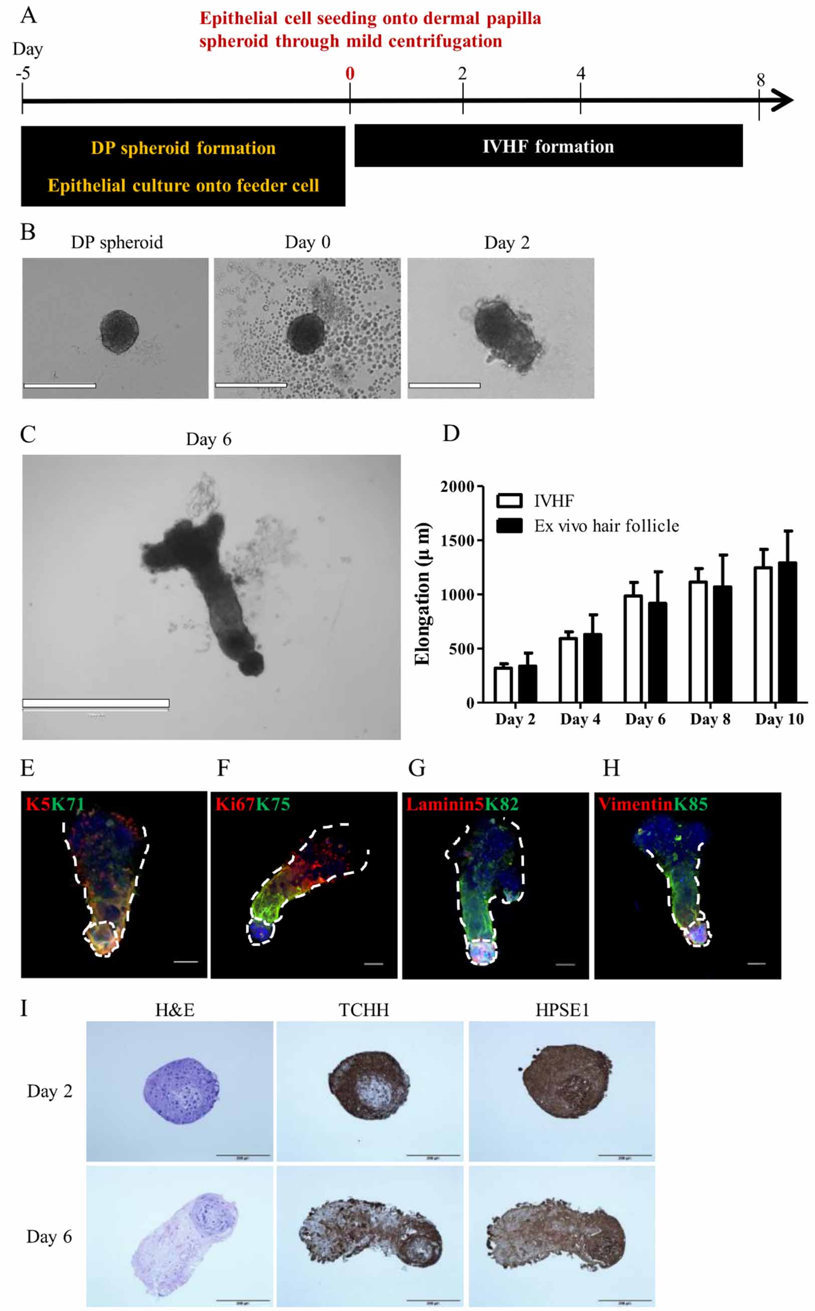 The development of an in vitro human hair follicle organoid with a ...