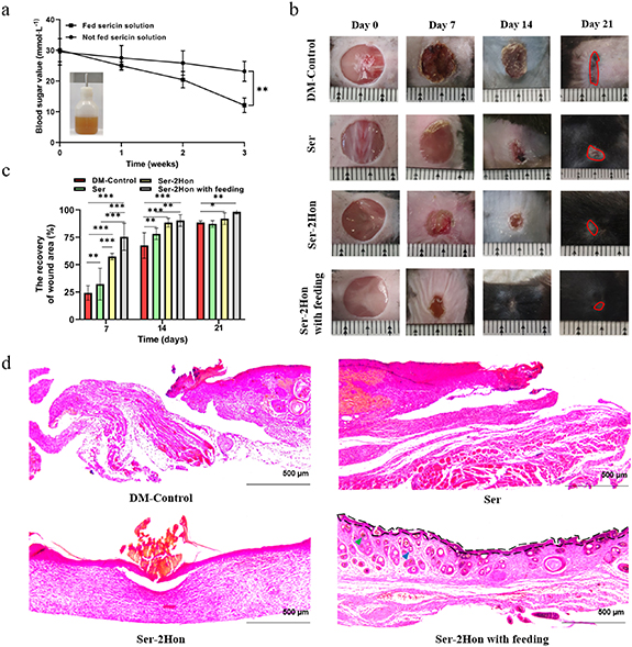Transparent injectable sericin-honey hydrogel with antioxidant and ...