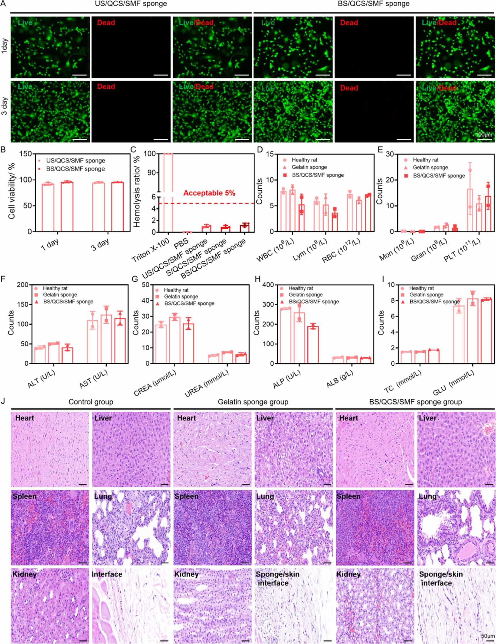 A macroporous composite sponge with high water absorbency and active ...