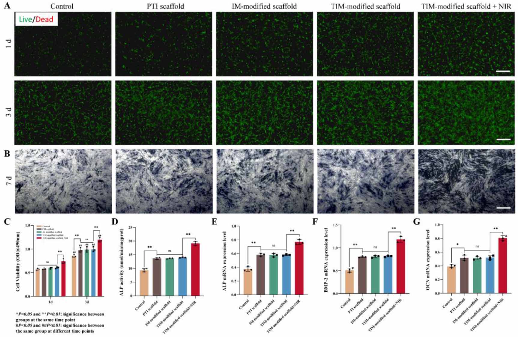 Ti3C2Tx@PLGA/Icaritin microspheres-modified PLGA/β-TCP scaffolds ...