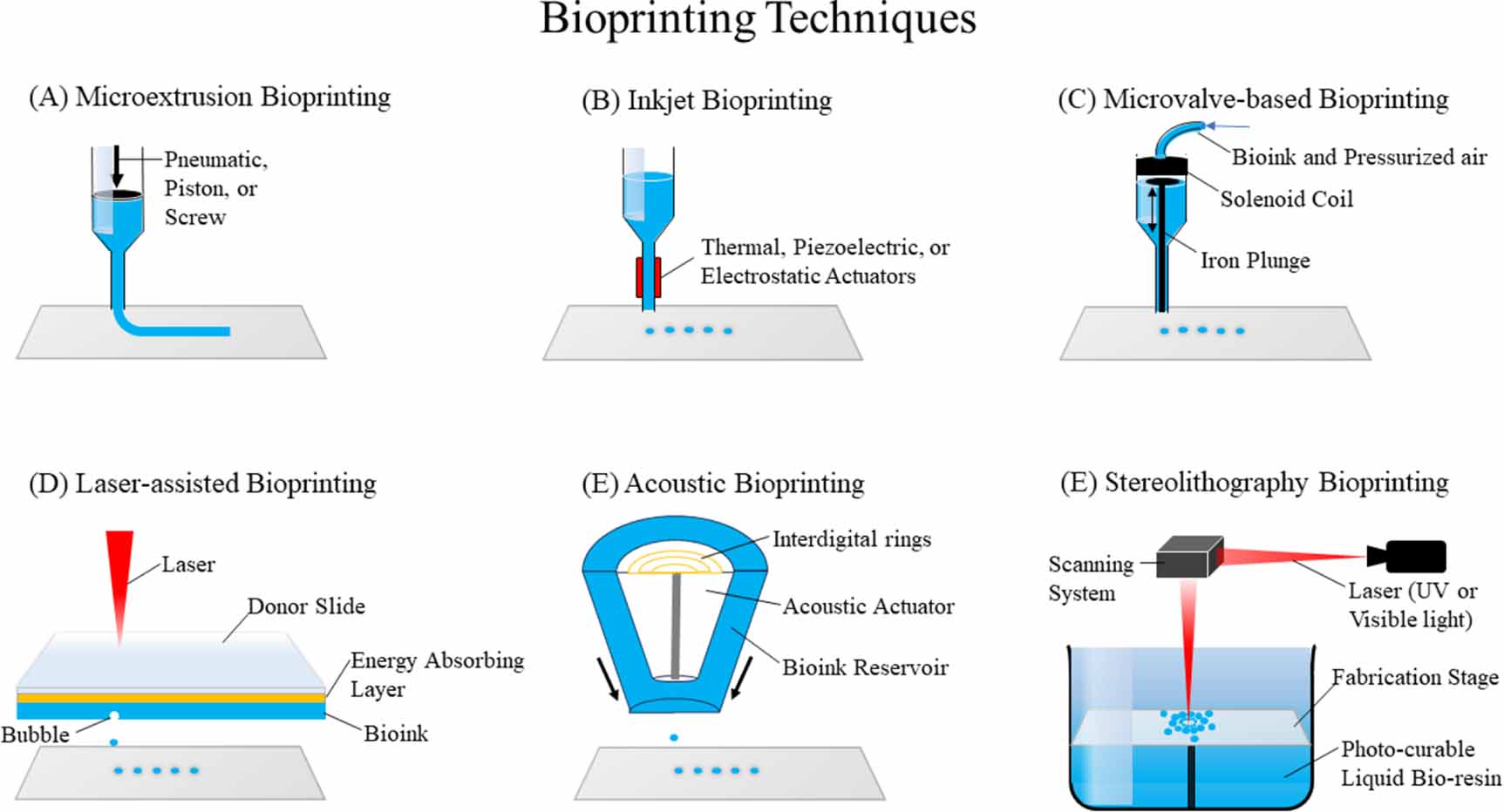 From lab to life: advances in in-situ bioprinting and bioink technology ...