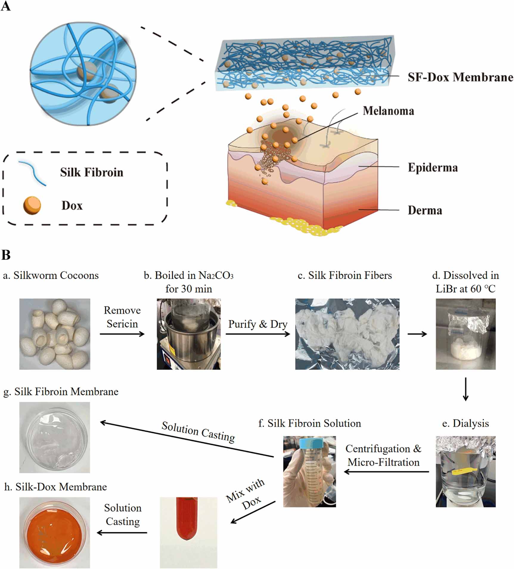 Biodegradable silk fibroin membranes for potential localized treatment ...