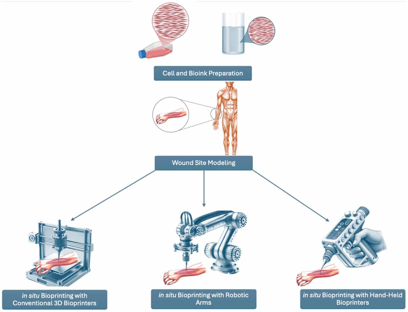 Hand-held bioprinters assisting in situ bioprinting - IOPscience