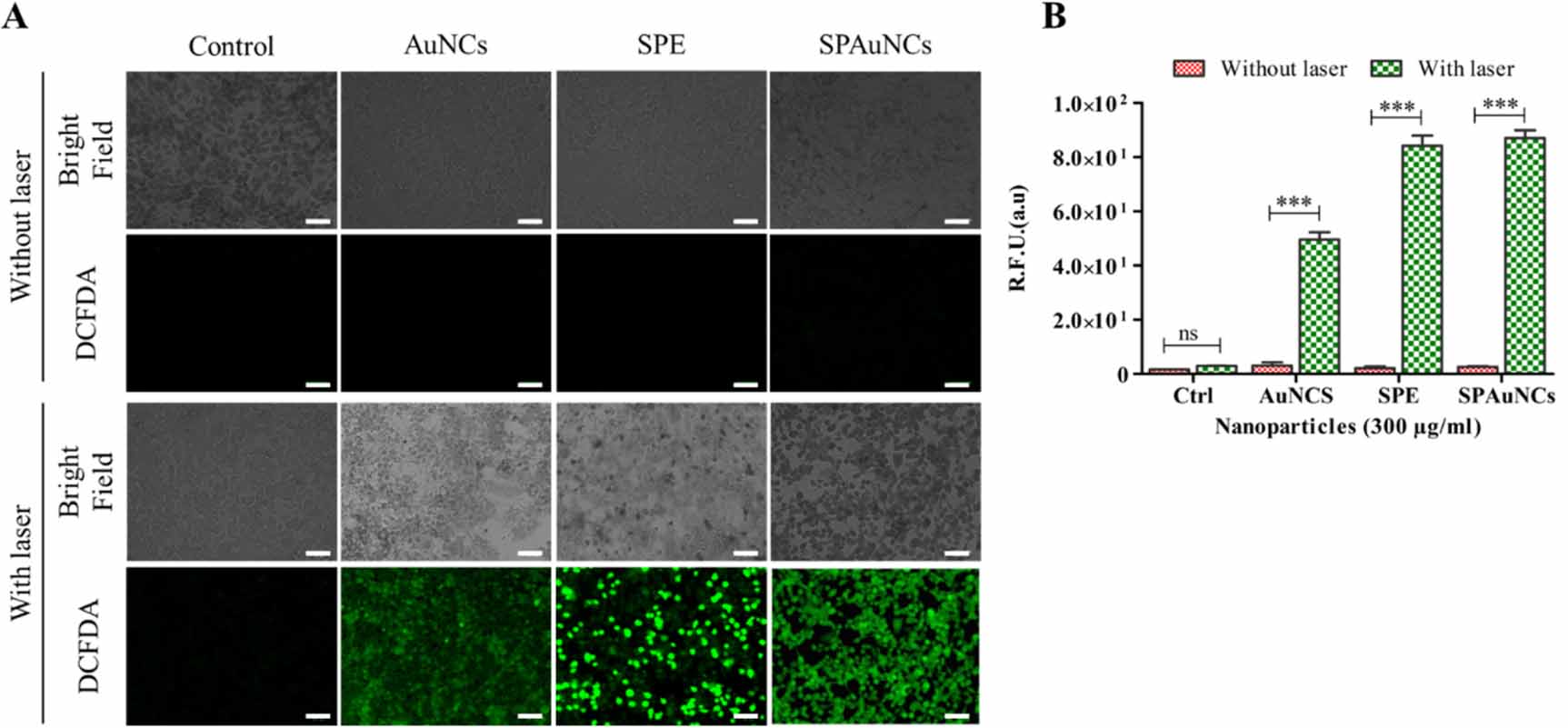 Gold nanocages co-assembled with Spinacia oleracea extract combined ...