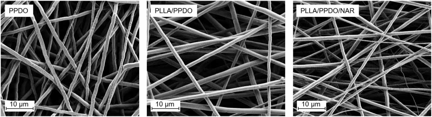 A coaxial electrospun PLLA/PPDO/NAR mesh for abdominal wall hernia ...