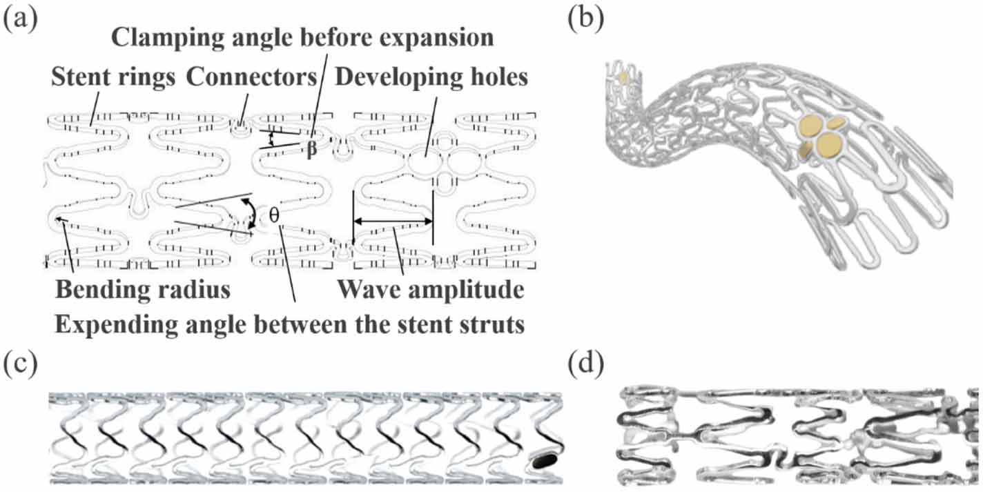 Recent advances and perspectives in bioresorbable metal coronary drug ...
