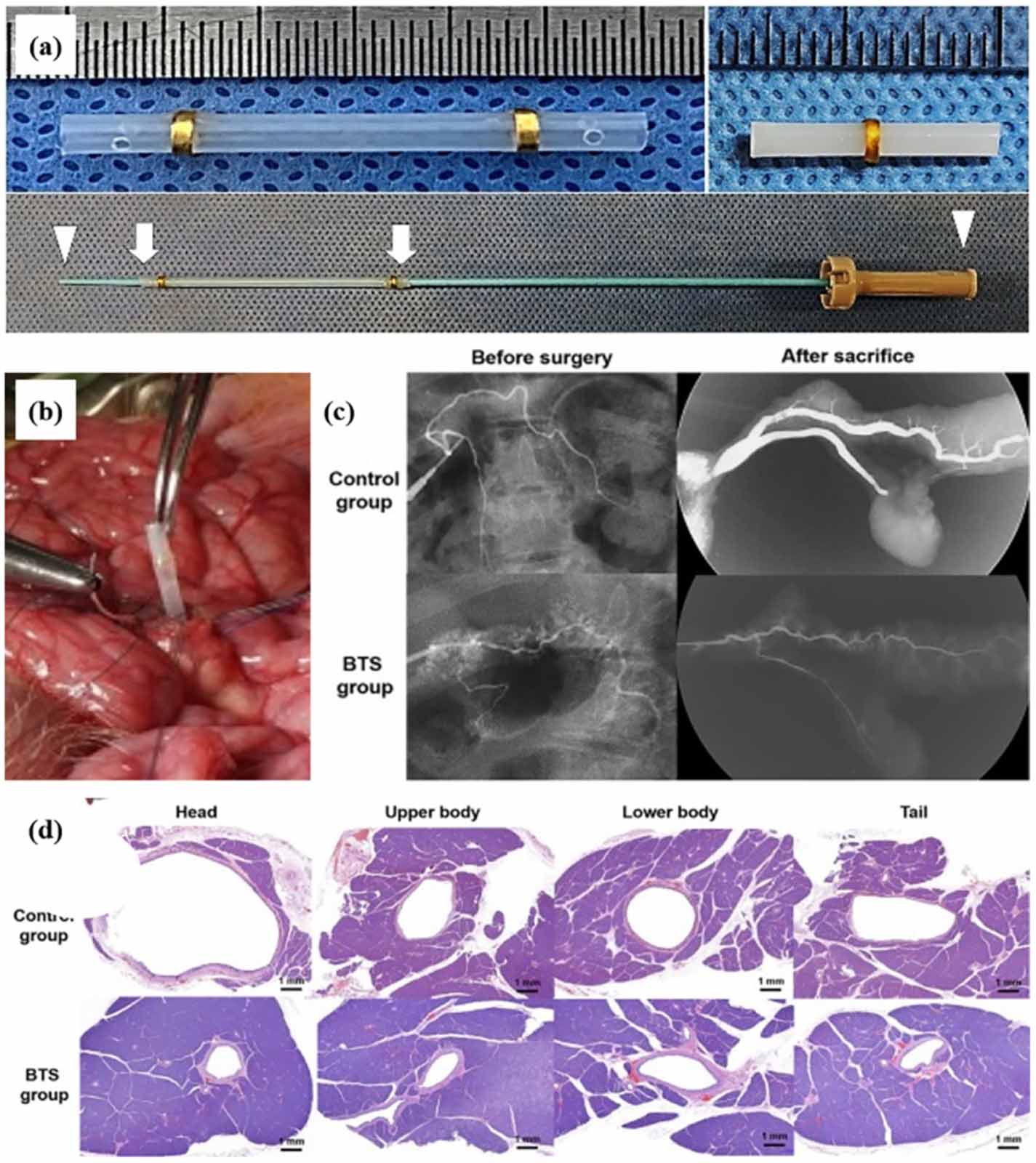A review on pancreatic duct stents: materials and emerging trends ...