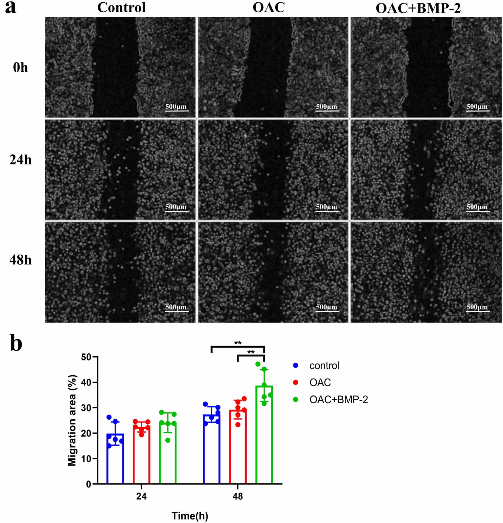 Bilayer oxidized sodium alginate–carboxymethyl chitosan hydrogel ...