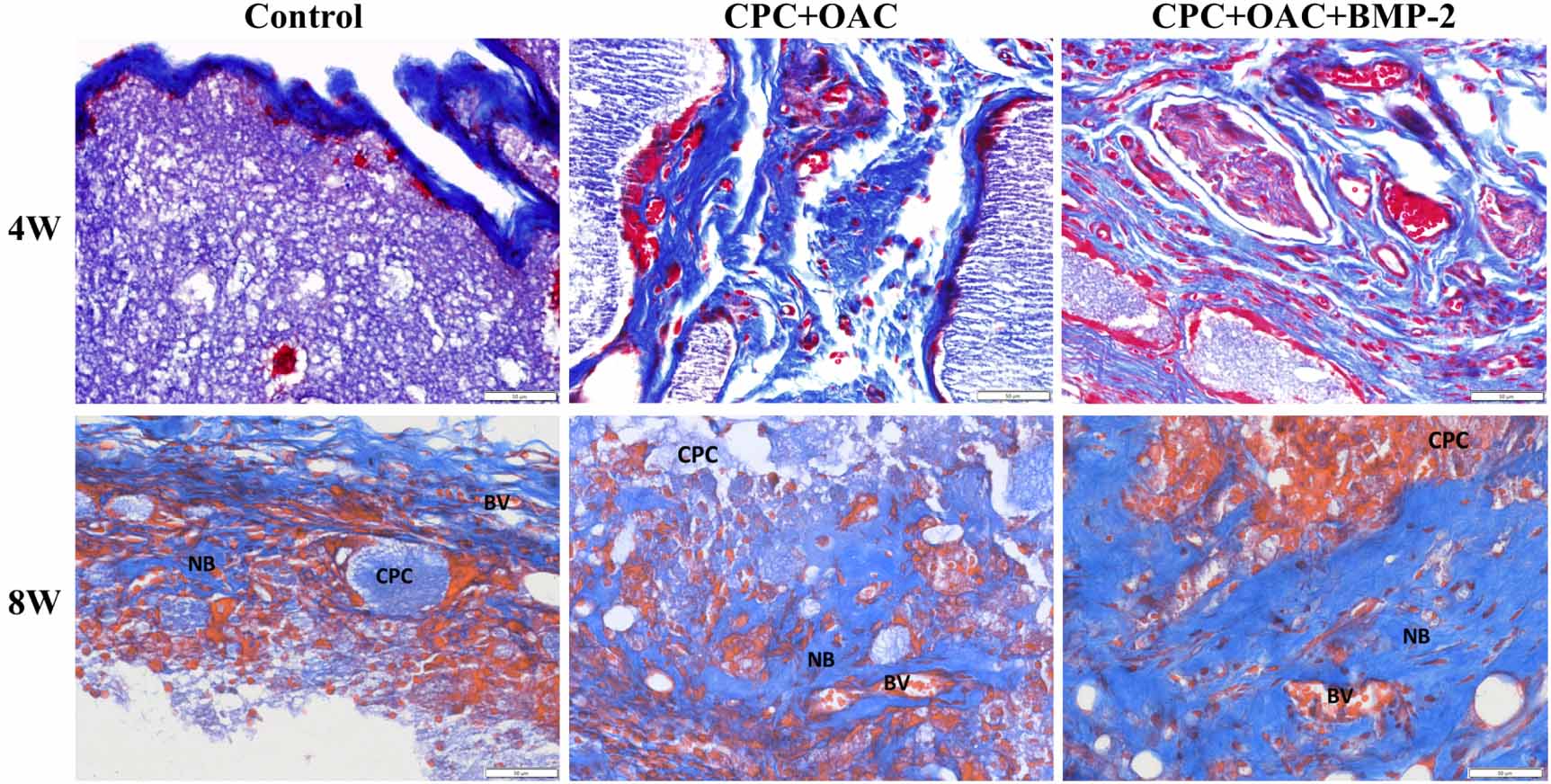 Bilayer oxidized sodium alginate–carboxymethyl chitosan hydrogel ...