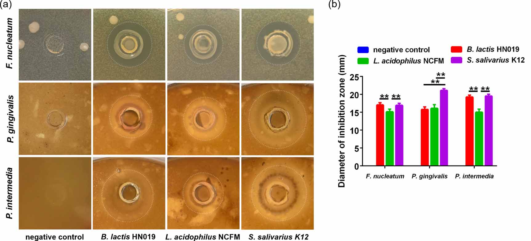 Effects of Bifidobacterium lactis HN019 and Lactobacillus acidophilus ...