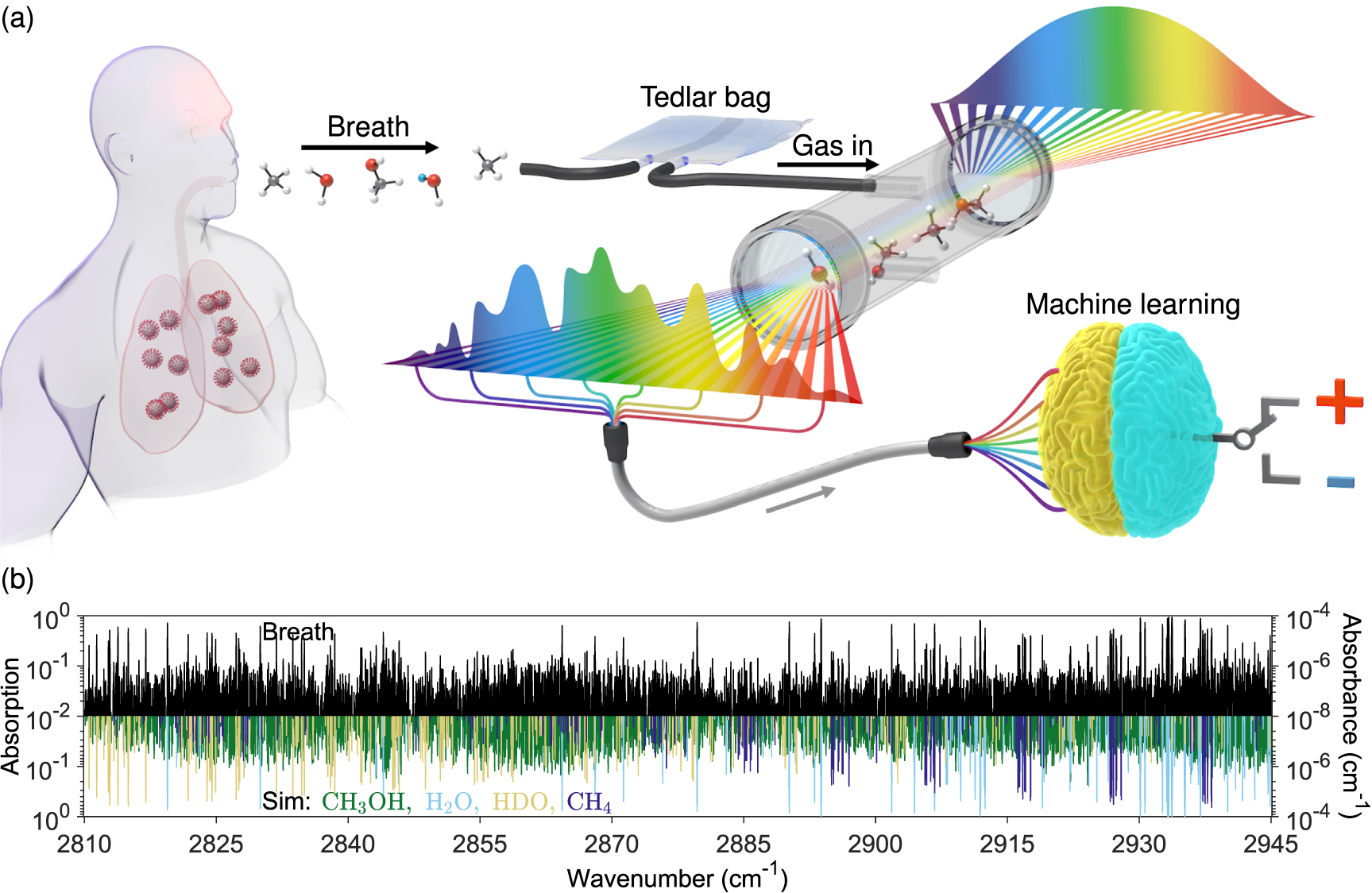 Breath analysis by ultra-sensitive broadband laser spectroscopy detects ...