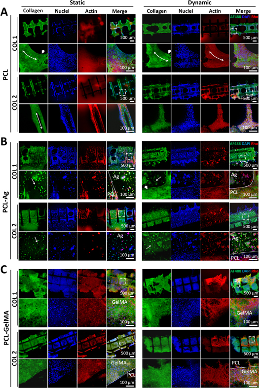 A 3D printed PCL/hydrogel construct with zone-specific biochemical ...