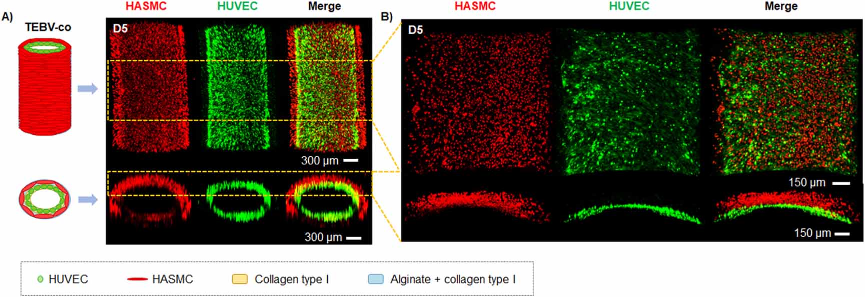 Direct extrusion of individually encapsulated endothelial and smooth ...