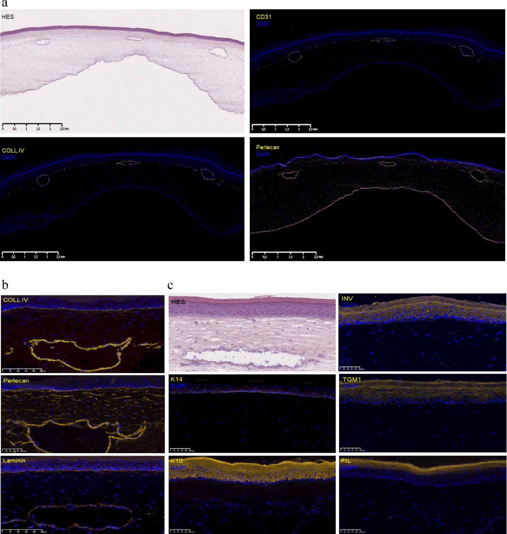 A perfusable vascularized full-thickness skin model for potential ...