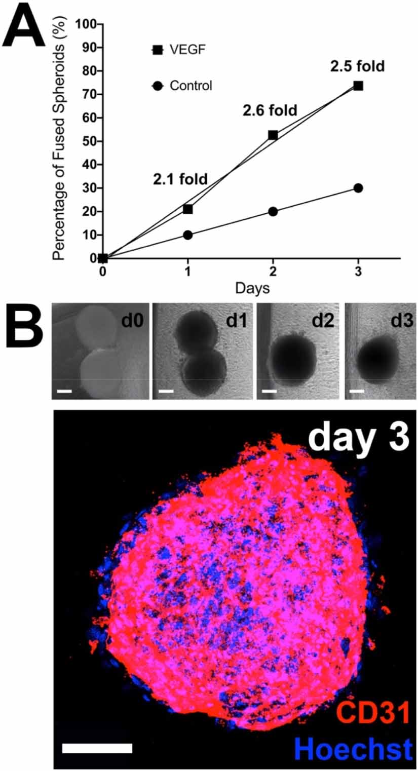 Towards engineering heart tissues from bioprinted cardiac spheroids ...