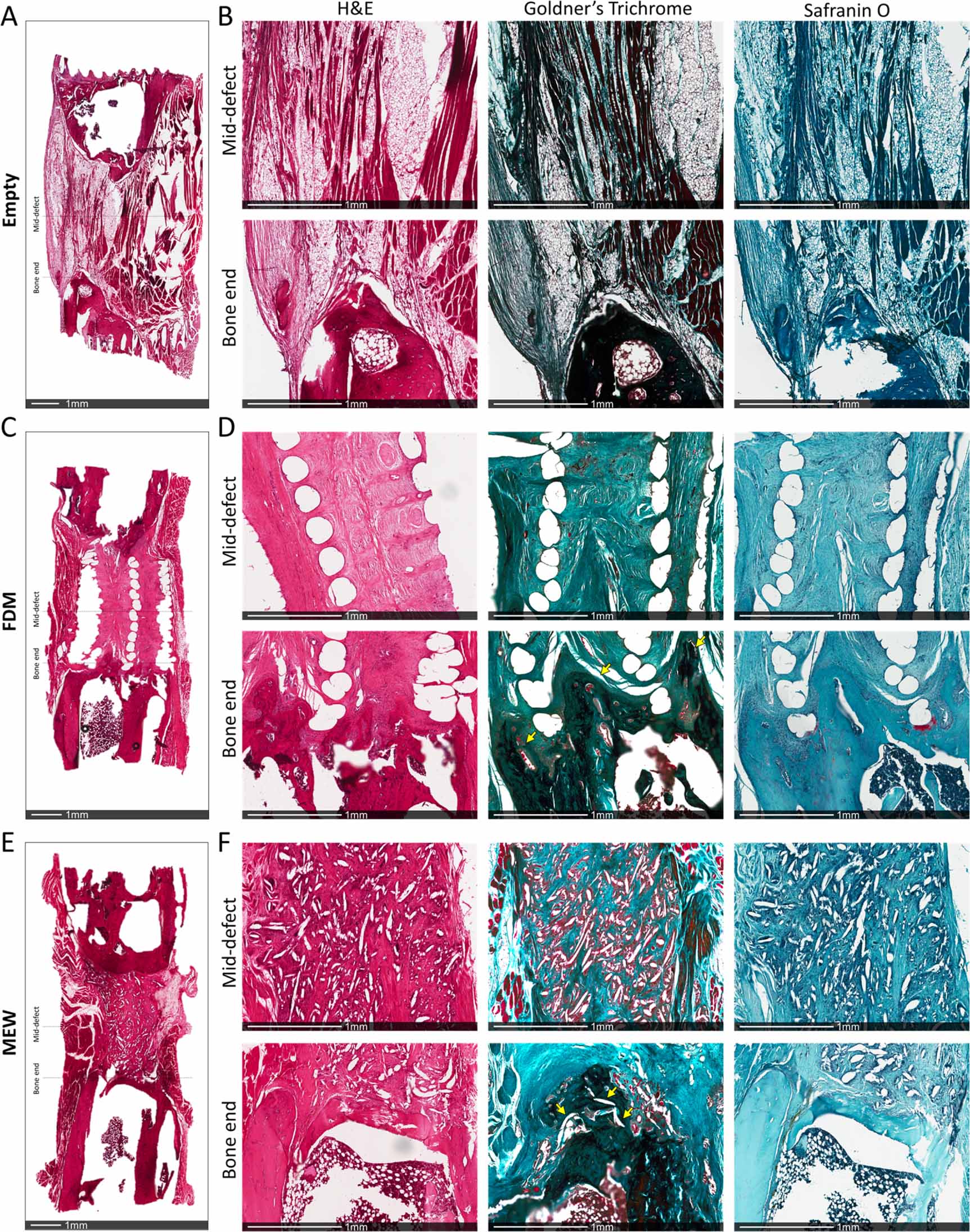 Scaffold microarchitecture regulates angiogenesis and the regeneration ...