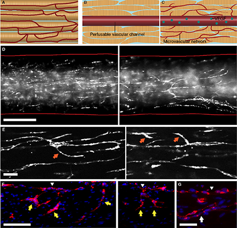 Multiscale engineered human skeletal muscles with perfusable ...