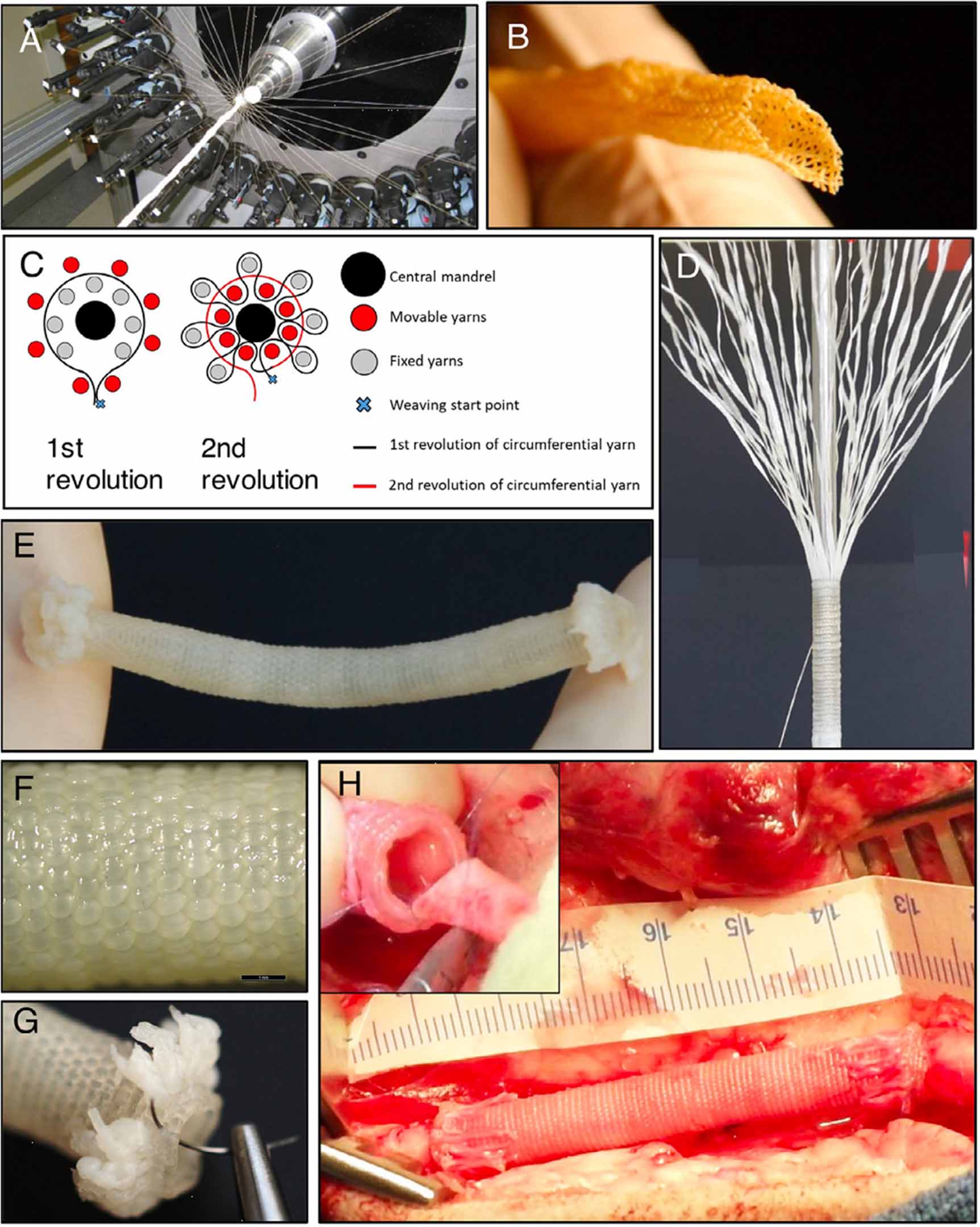 Current biofabrication methods for vascular tissue engineering and an ...