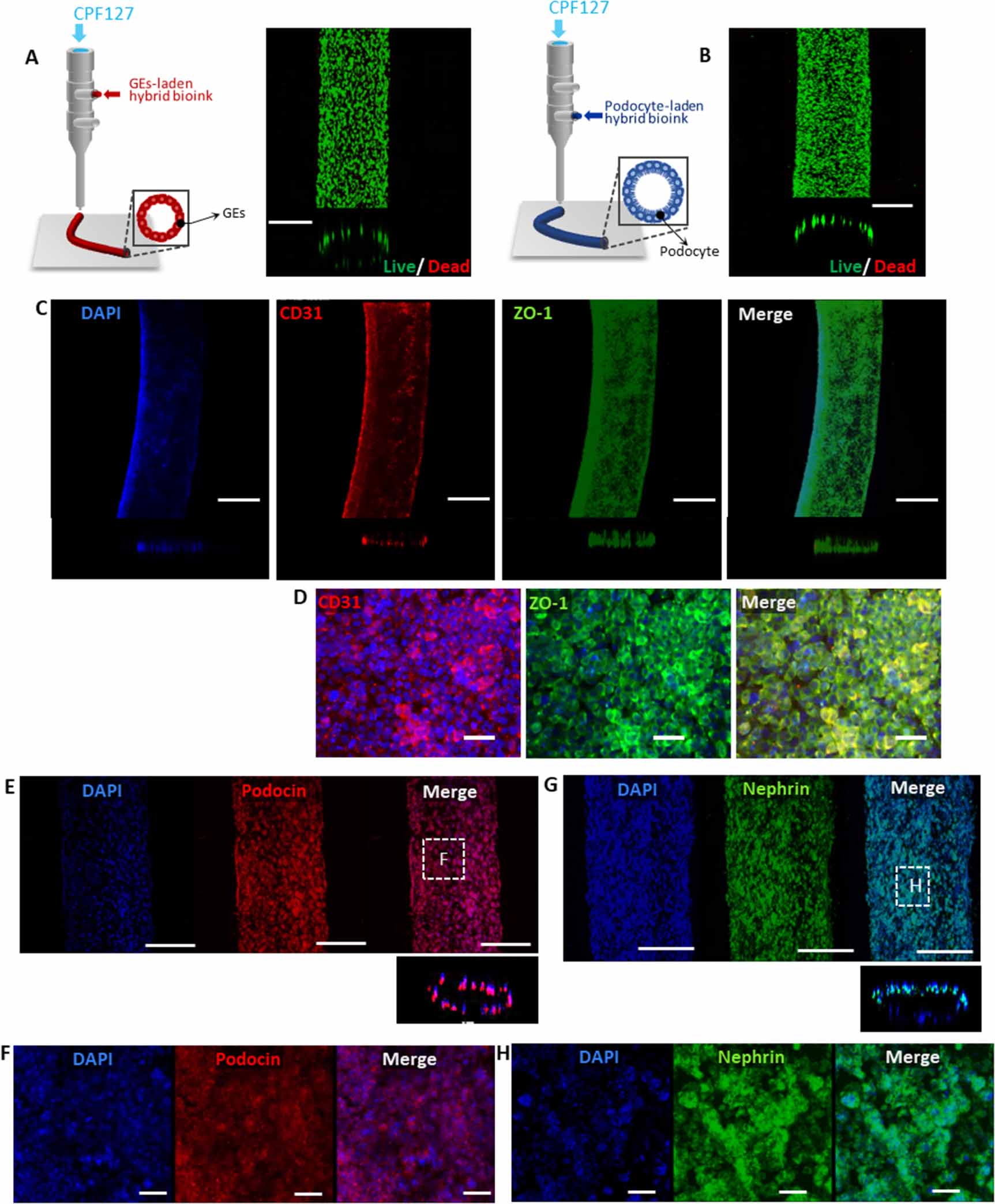 Coaxial cell printing of a human glomerular model: an in vitro ...