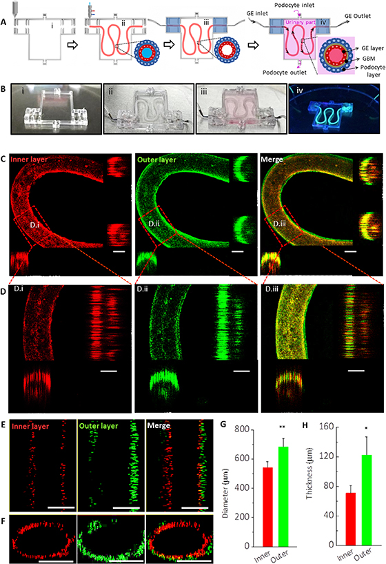 Coaxial cell printing of a human glomerular model: an in vitro ...