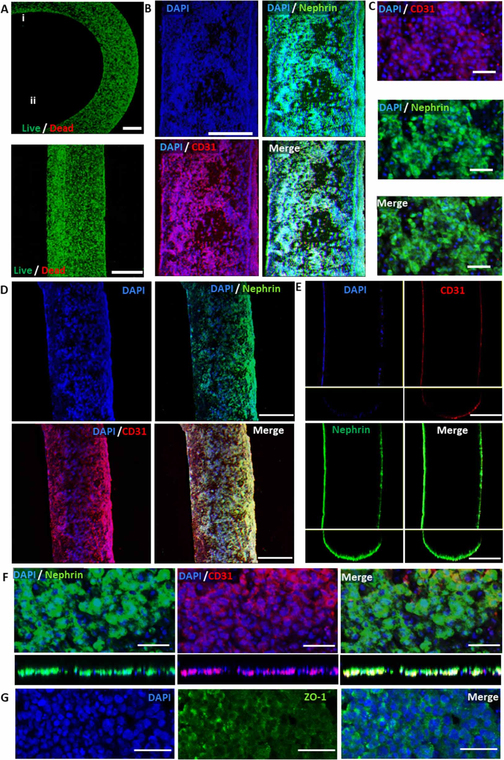 Coaxial cell printing of a human glomerular model: an in vitro ...