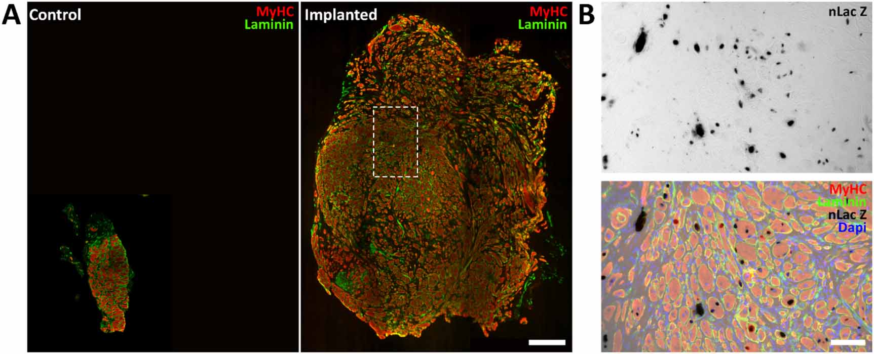 A novel extrusion-based 3D bioprinting system for skeletal muscle ...