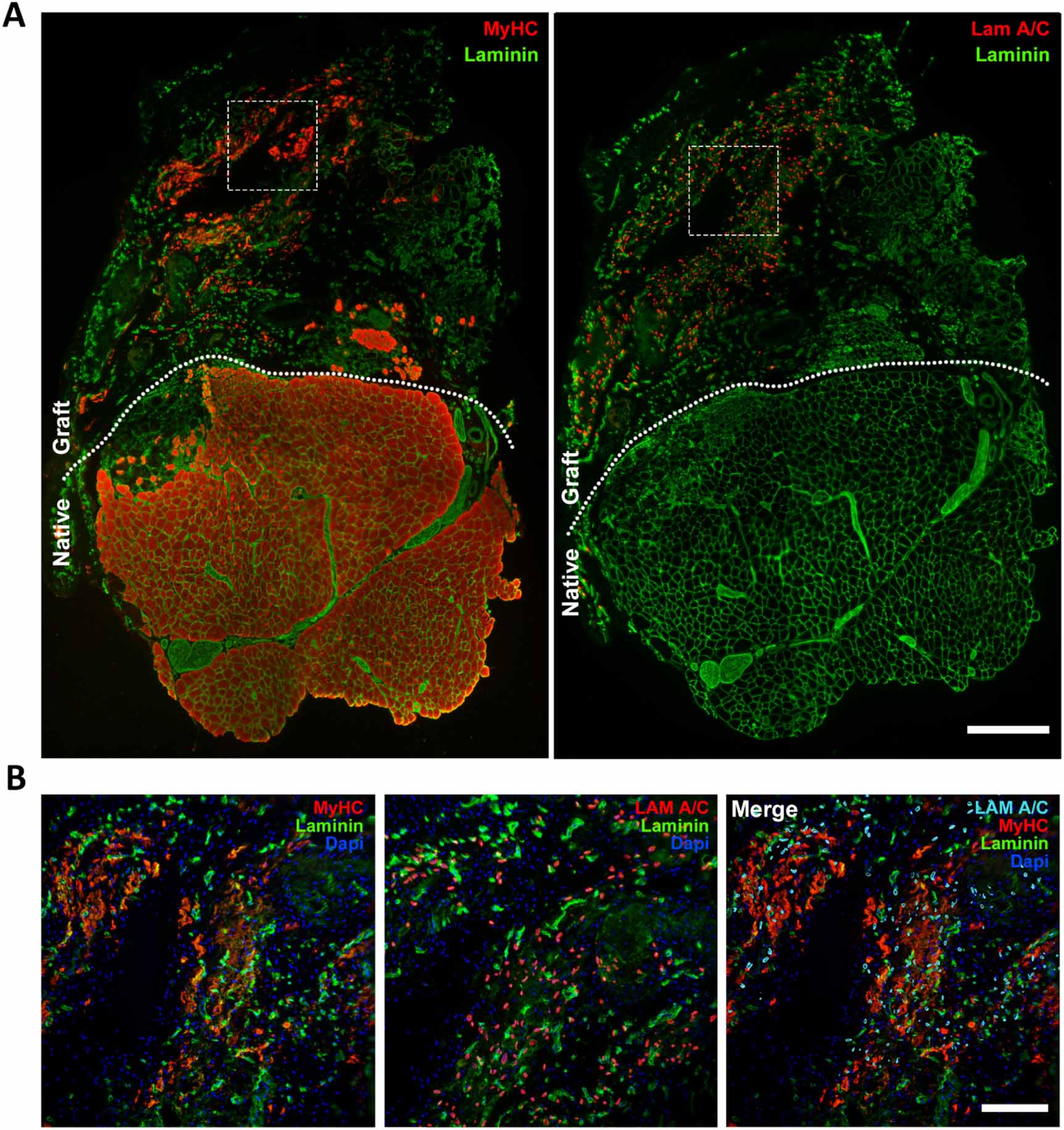 A novel extrusion-based 3D bioprinting system for skeletal muscle ...