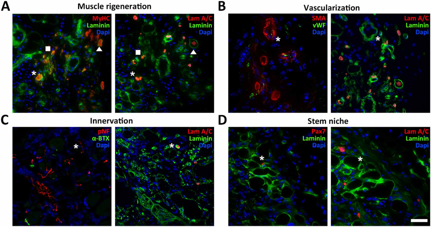 A novel extrusion-based 3D bioprinting system for skeletal muscle ...