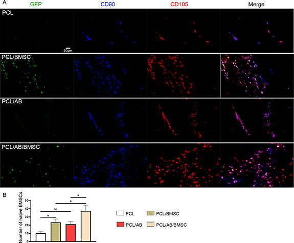 3D bioprinted autologous bone particle scaffolds for cranioplasty ...