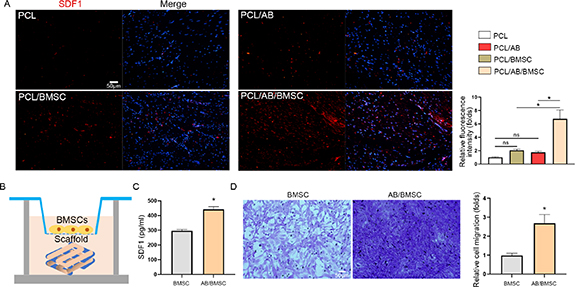 3D bioprinted autologous bone particle scaffolds for cranioplasty ...