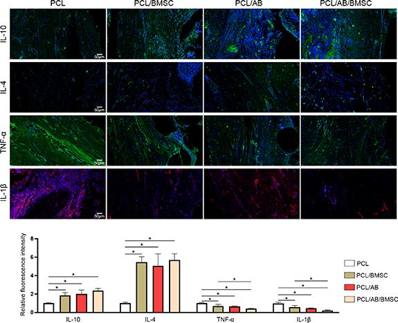 3D bioprinted autologous bone particle scaffolds for cranioplasty ...