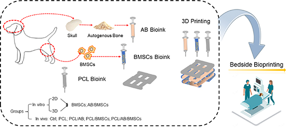 3D bioprinted autologous bone particle scaffolds for cranioplasty ...