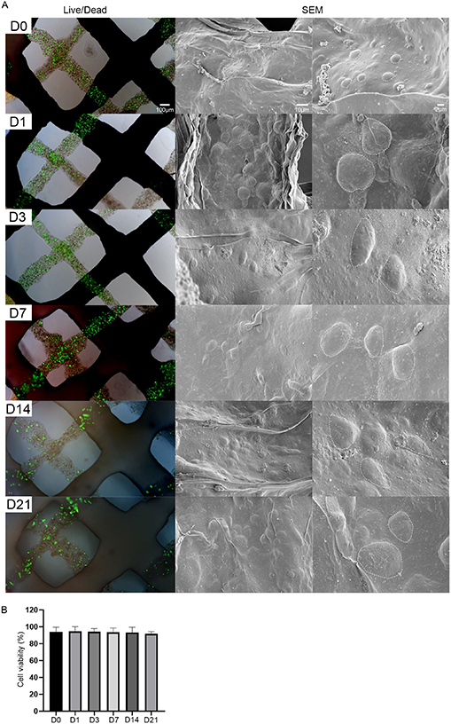 3D bioprinted autologous bone particle scaffolds for cranioplasty ...
