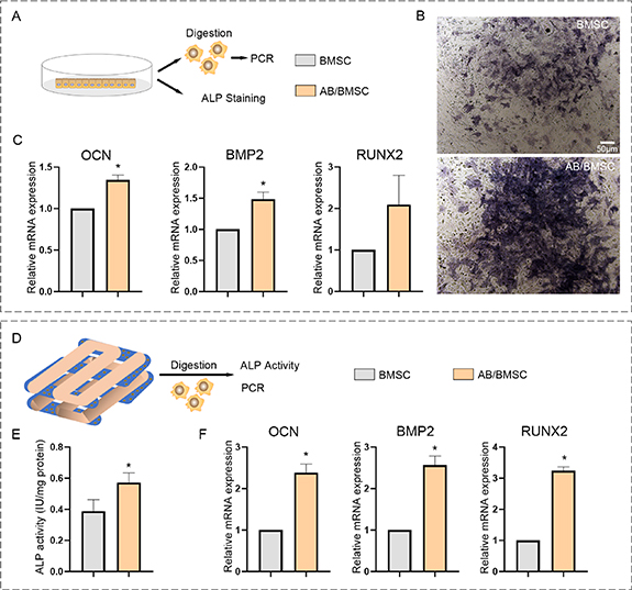 3D bioprinted autologous bone particle scaffolds for cranioplasty ...