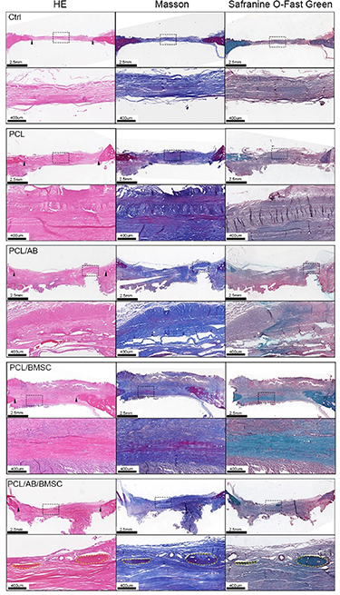 3D bioprinted autologous bone particle scaffolds for cranioplasty ...
