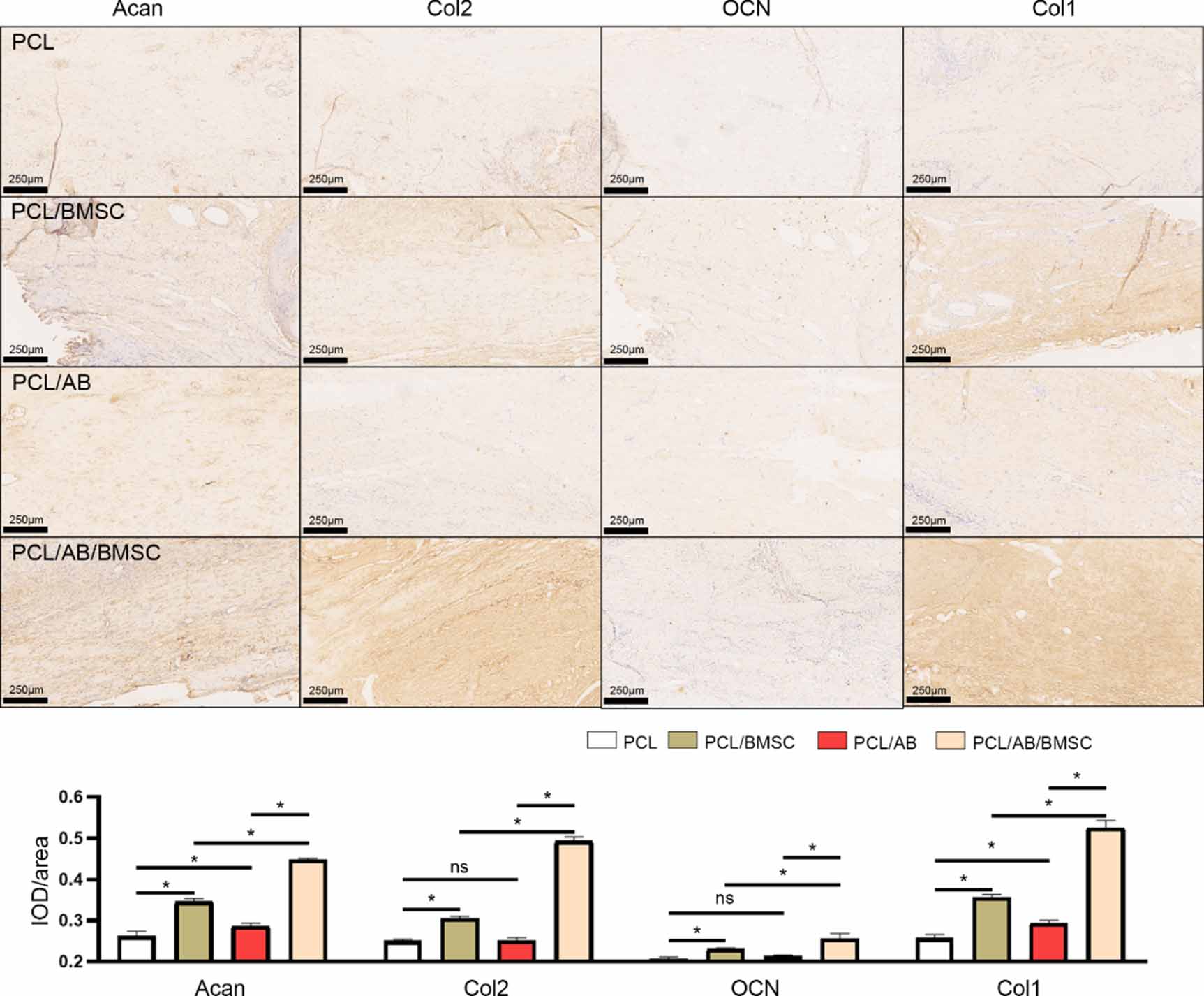 3D bioprinted autologous bone particle scaffolds for cranioplasty ...