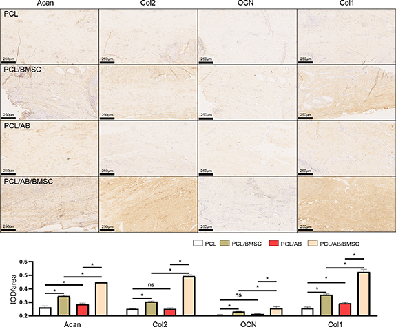 3D bioprinted autologous bone particle scaffolds for cranioplasty ...