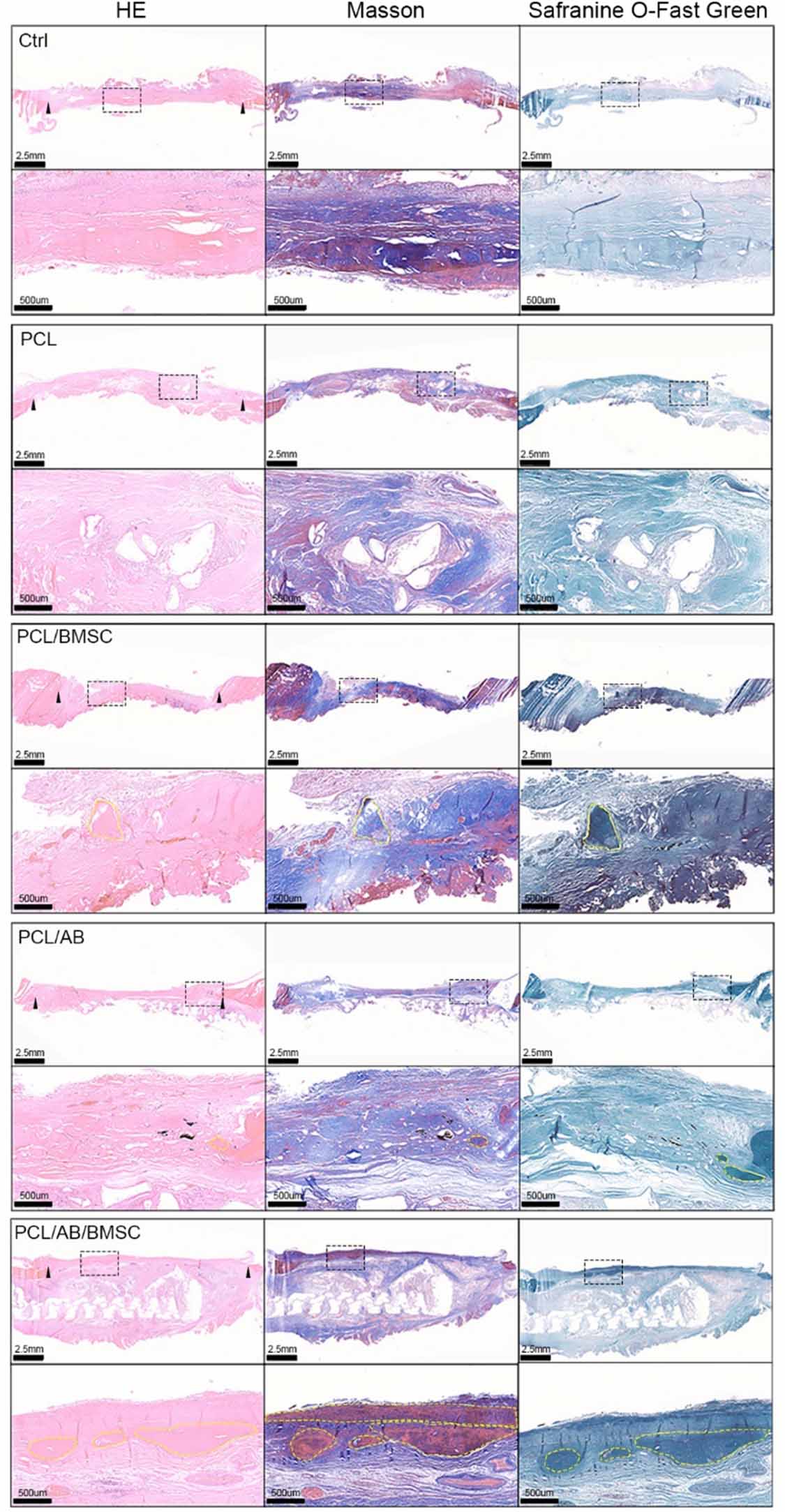 3D bioprinted autologous bone particle scaffolds for cranioplasty ...